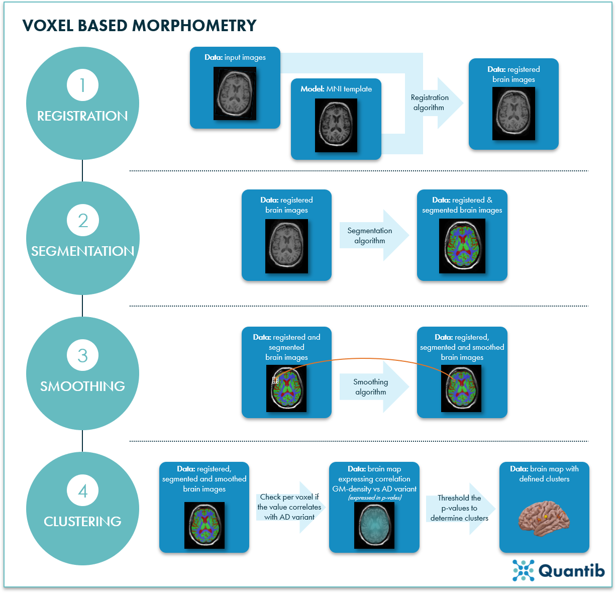 Linking MRI brain images to genetic profiles at voxel level: an imaging genetics example